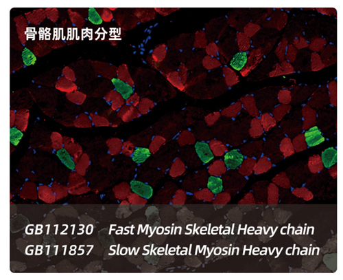 TSA Fluorescence Double Staining Kit Tyramide Signal Amplification ...